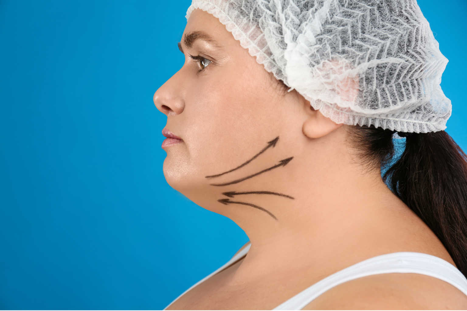 Double Chin Removal Singapore, Non-Surgical Double Chin Fat Reduction